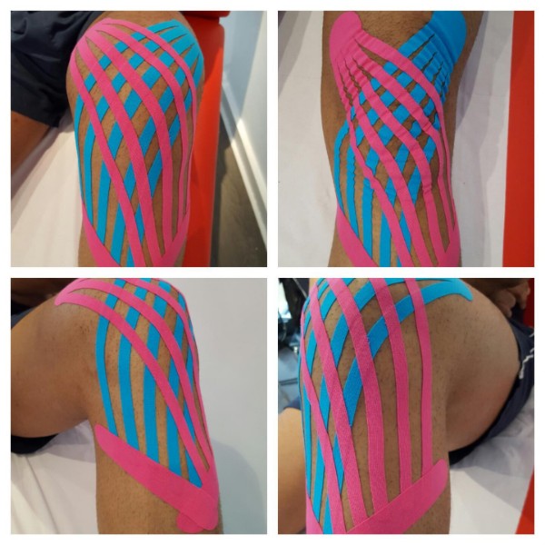 Straping, taping Paris 16